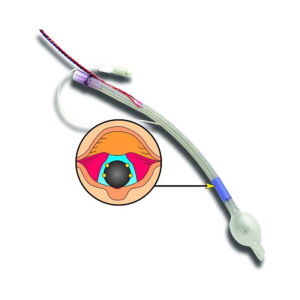 NIM EMG endotracheal tube - Getremed